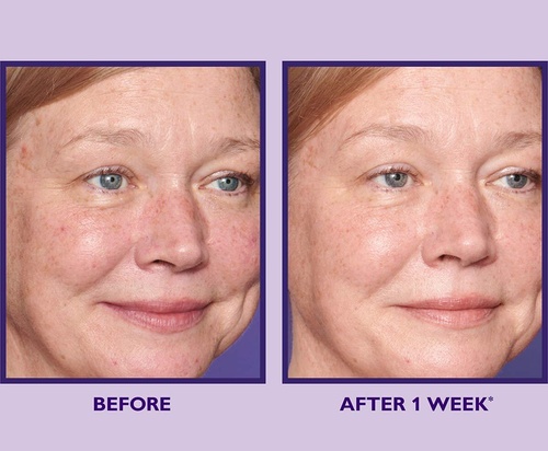 PETER THOMAS ROTH Ultimate Solution 5™ Multitasking Moisturizer » buy ...