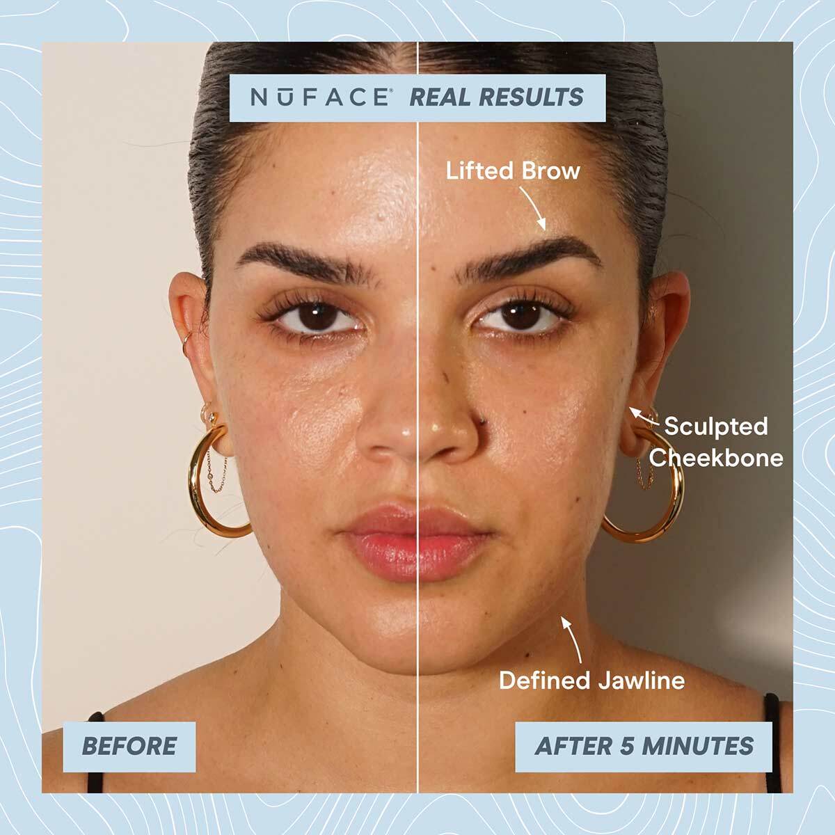 NUFACE Mini+ Starter Kit » online kaufen | NICHE BEAUTY