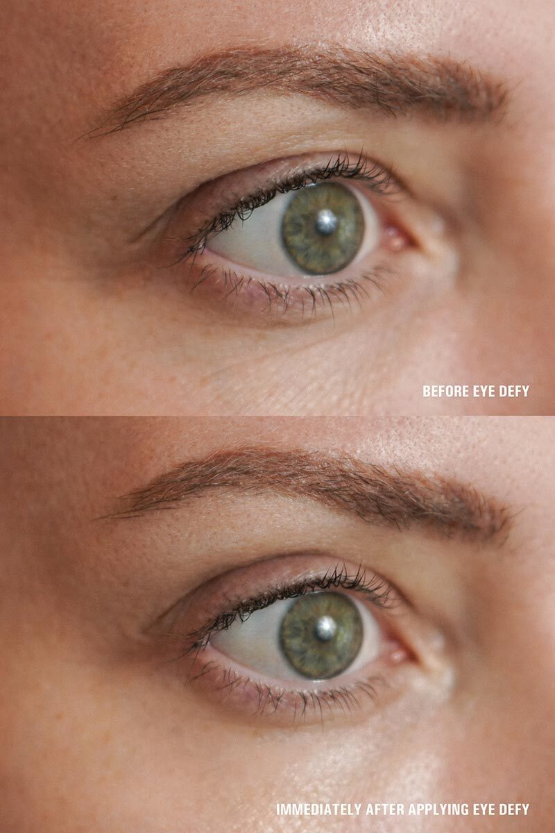 GOLDFADEN MD Radiance Restoring Eye Treatment » online kaufen | NICHE ...