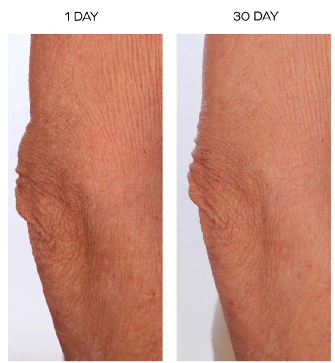 U BEAUTY The Sculpt Arm Compound » buy online | NICHE BEAUTY