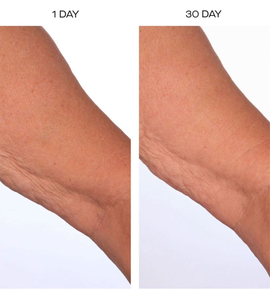 U BEAUTY The Sculpt Arm Compound » buy online | NICHE BEAUTY