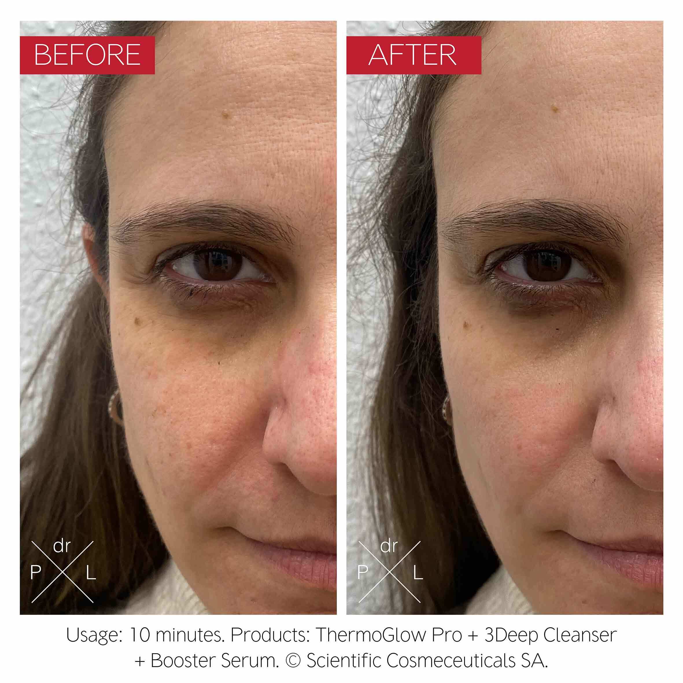 DR. LEVY SWITZERLAND The ThermoGlow Pro » online kaufen | NICHE BEAUTY